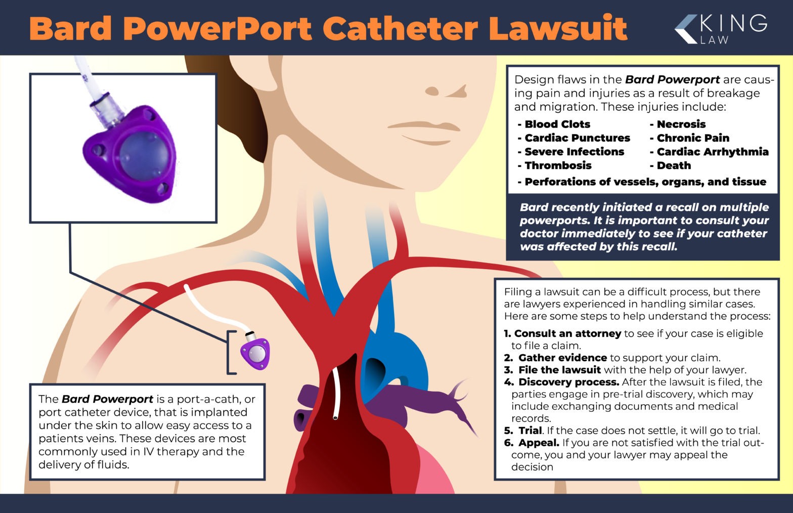 Bard PowerPort Lawsuit - October 2025 Update | King Law